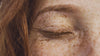 Dehydrated Skin: Causes of Fine Lines and Solutions