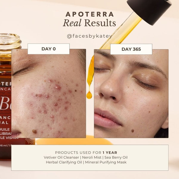 Sea Berry Balancing Facial Oil | Apoterra Skincare