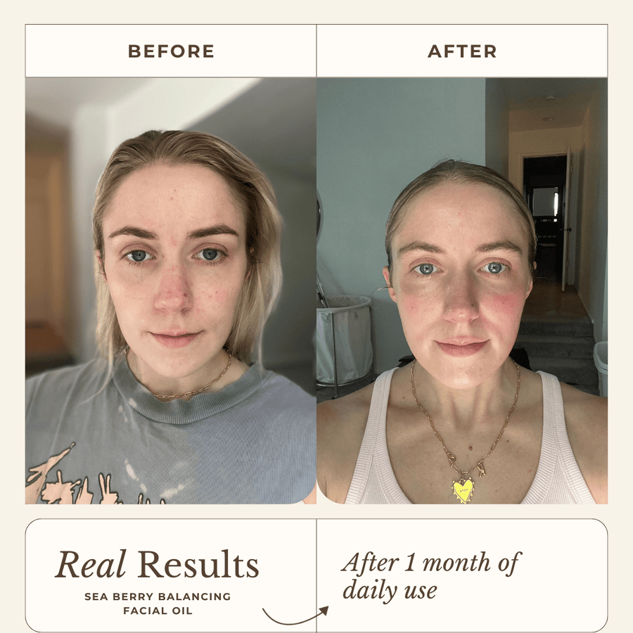 Sea Berry Balancing Facial Oil | Brightening, Clearing and Firming